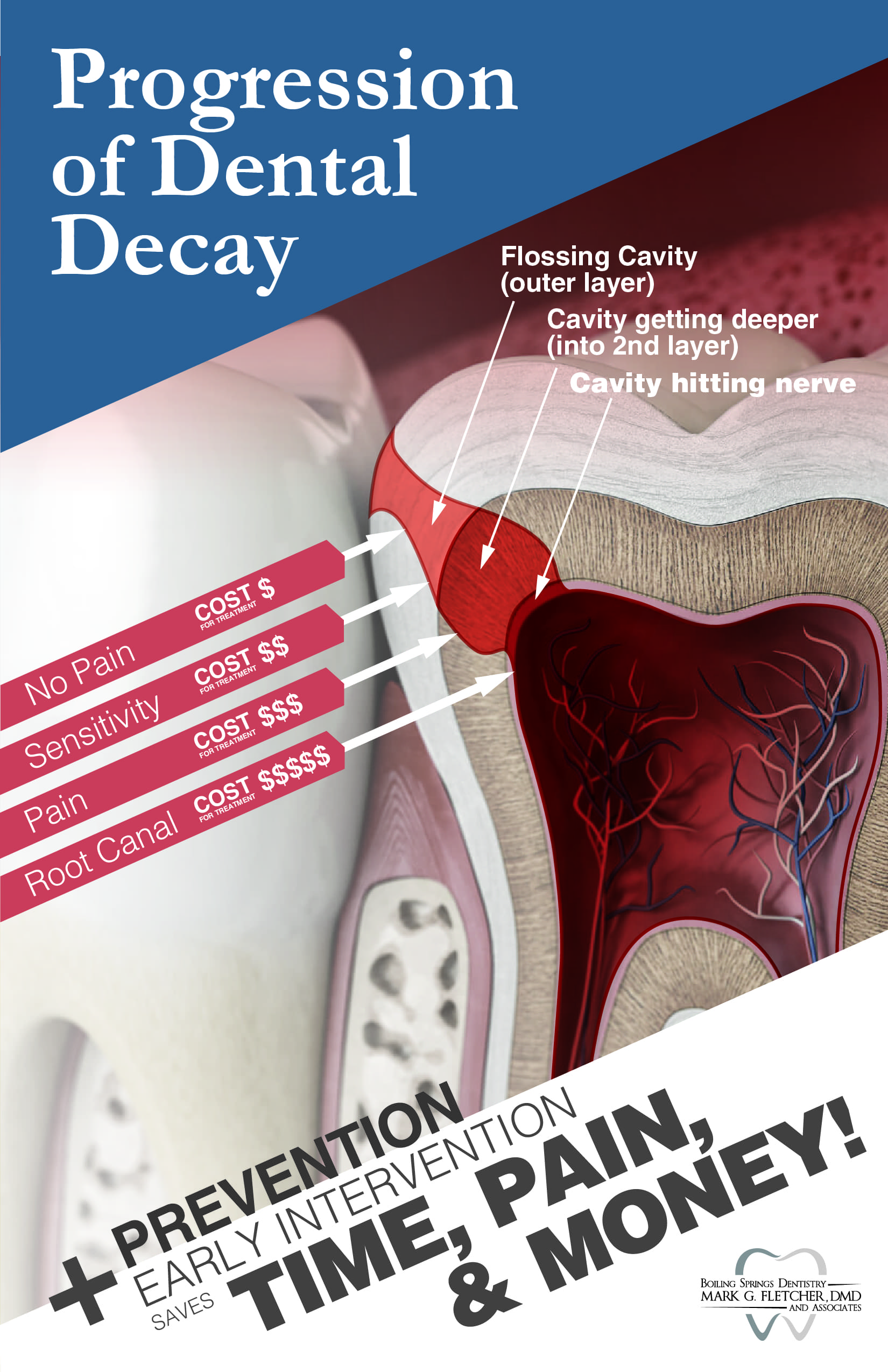 Tooth Pain Diagram | Boiling Springs Dentistry